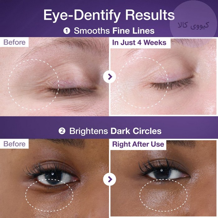 کرم دور چشم +NAD و رتینول شماره 9 نامبوزین Numbuzin پر کننده و جوانساز - فروشگاه کیووی کالا